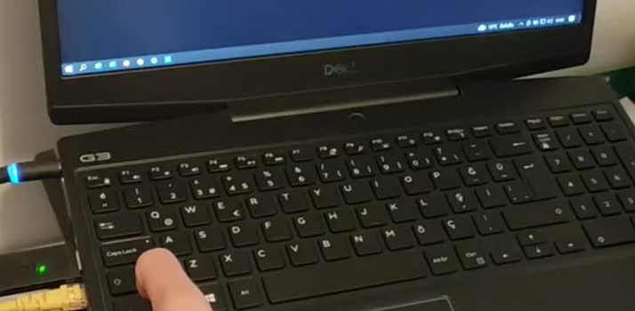 Dell G315 4b75d2f161c Laptop Işık Sızması - Şikayetvar