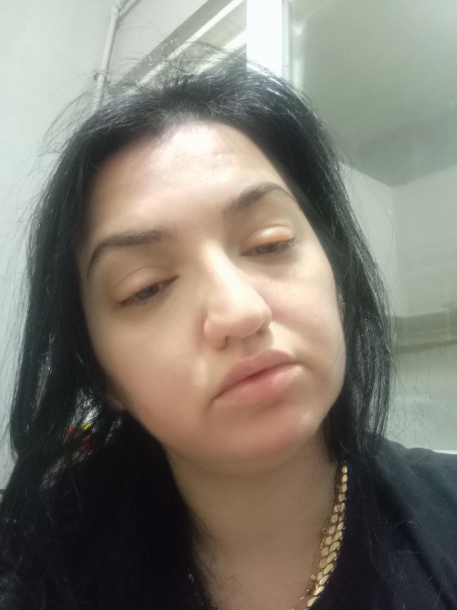 Golden Rose Rimel Tarihi Geçmiş Bozuk Ürün - Şikayetvar