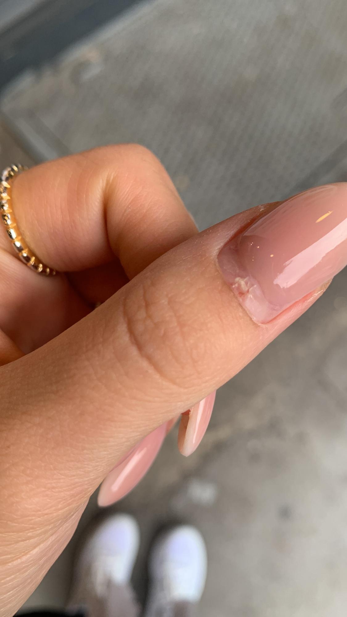 Dilara Özbek Nail Studio Tırnağıma Mantar Bulaştırdı - Şikayetvar