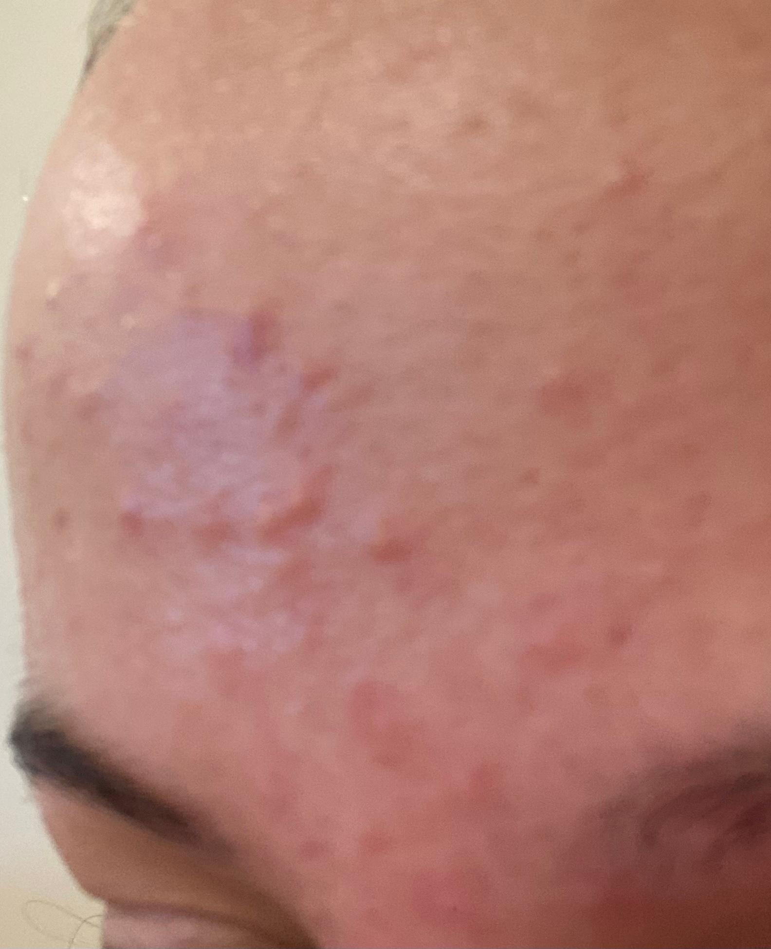 Garnier Hyaluronik Aloe Jel - Şikayetvar