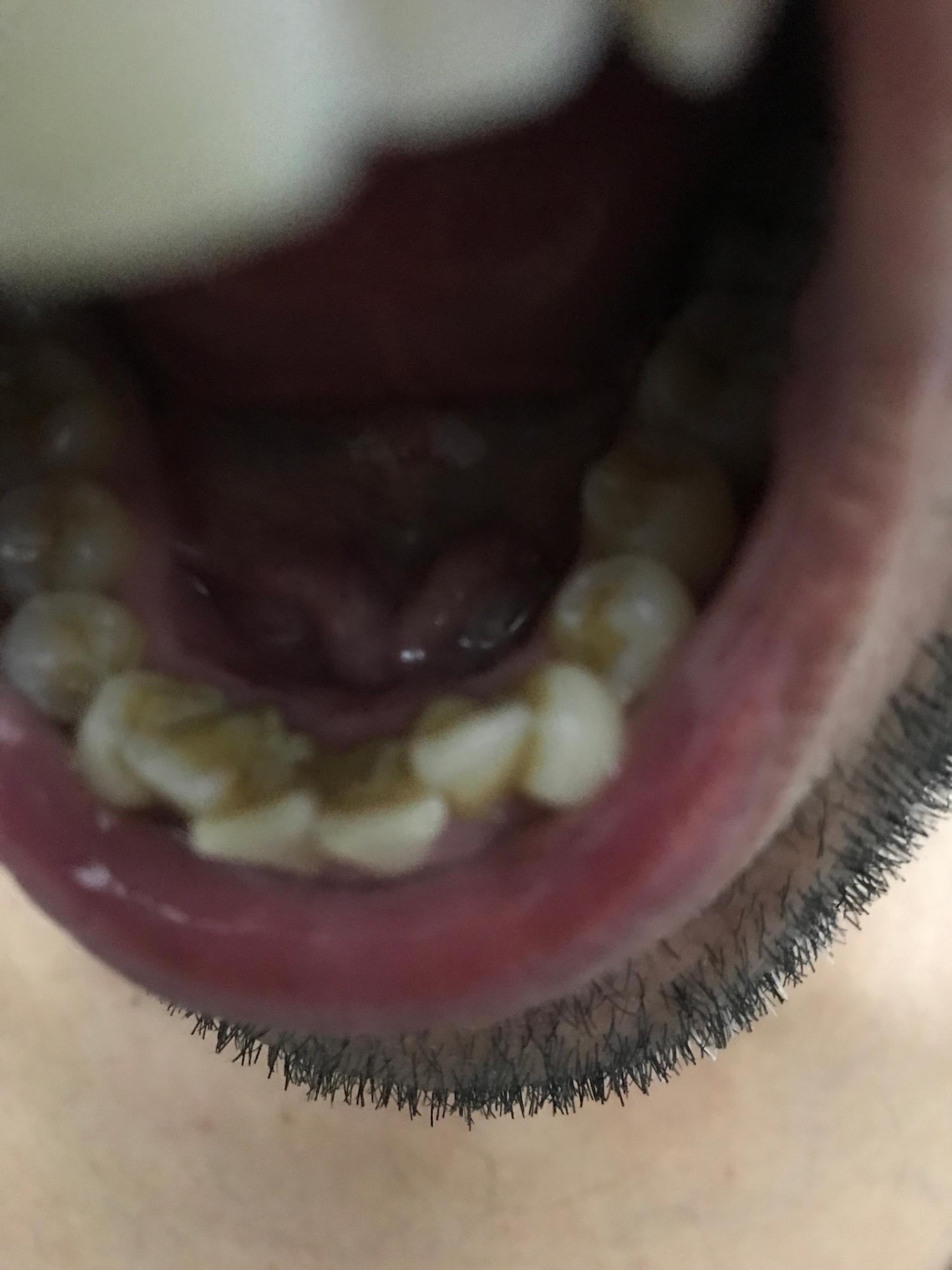 Şok Marketler Şok Market Deren İce Tea Skandalı - Şikayetvar