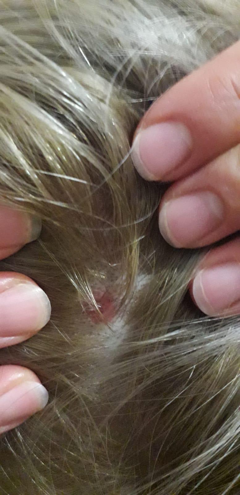 Palette Yüzünden Kafa Derim Yandı - Şikayetvar