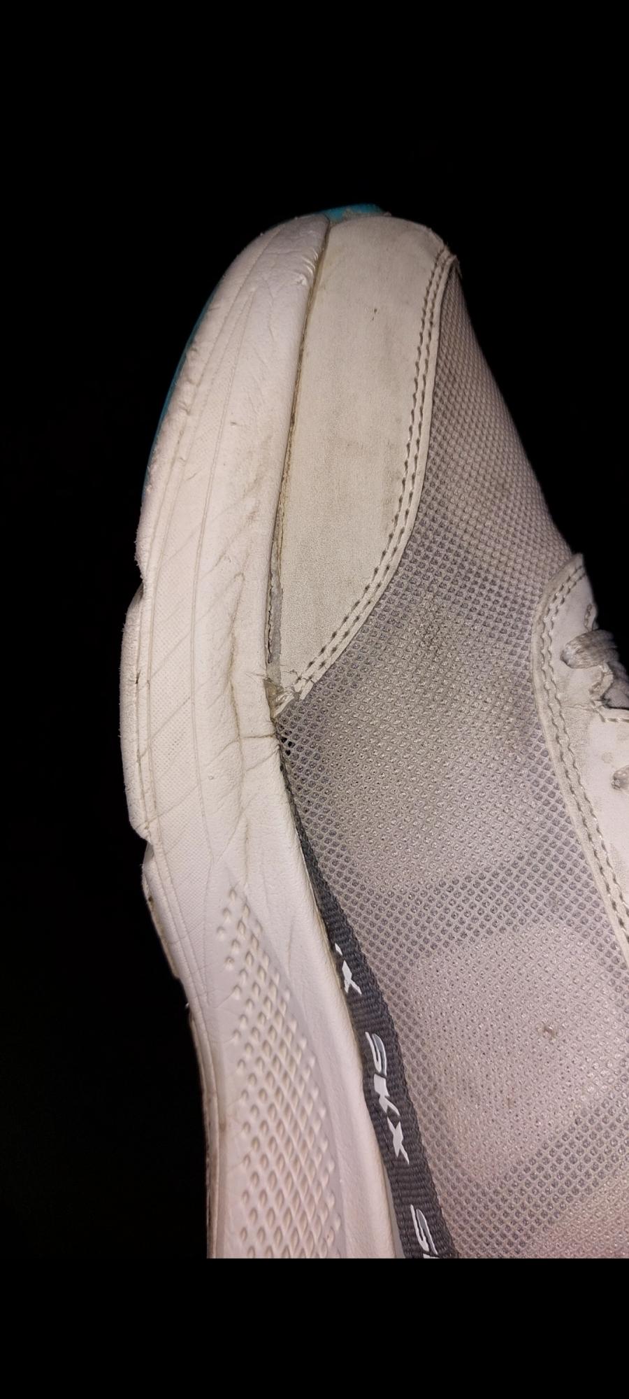 Poor Quality Skechers Shoes And Customer Dissatisfaction - Xolvie