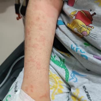 Atabay İlaç Firması Enfluvir Şurup Çocuğuma Yaptıkları - Şikayetvar