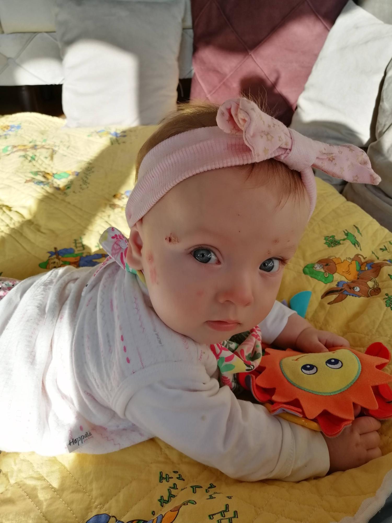 Çözüldü: Dr. Belda Yurtseven Tüner Alerji Problemlerine Profesyonel ...