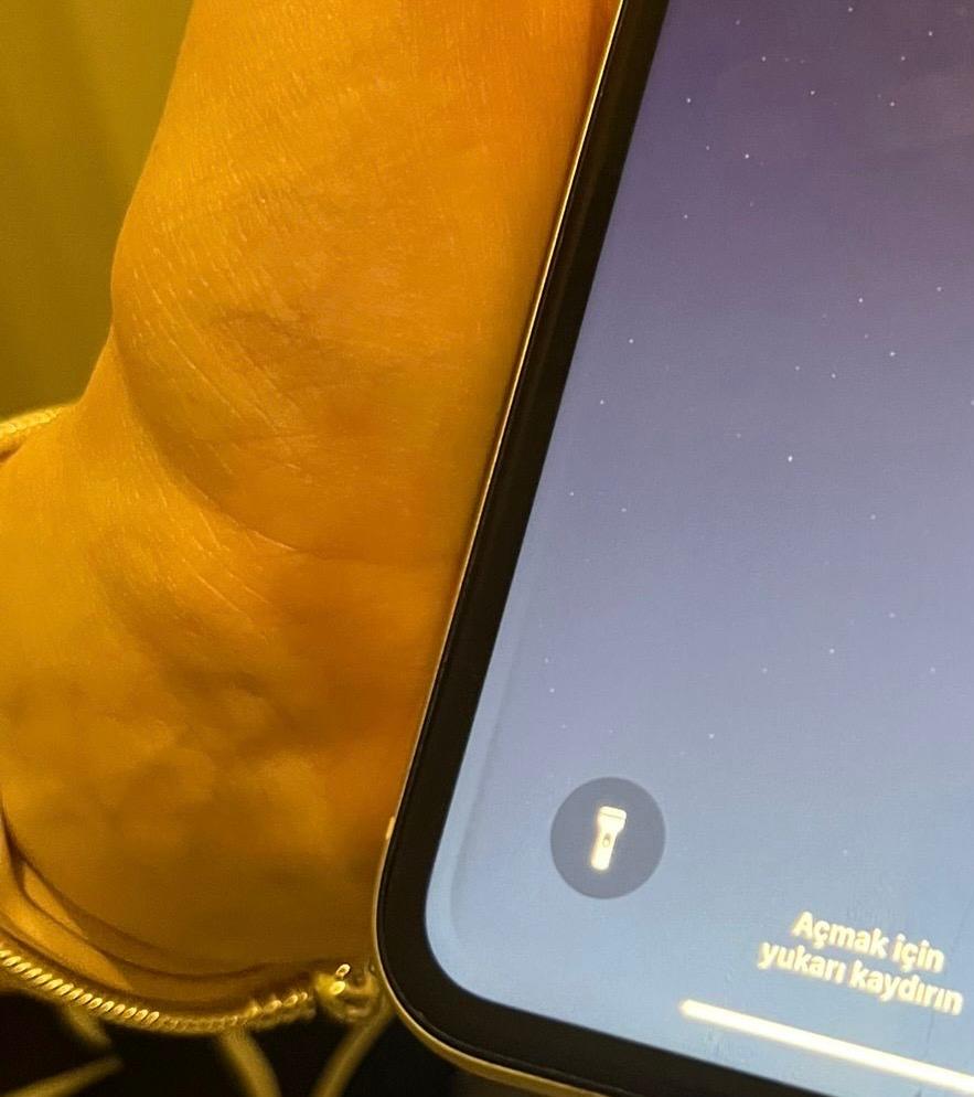 iPhone 11 Sol Alt Köşede Gölge - Şikayetvar