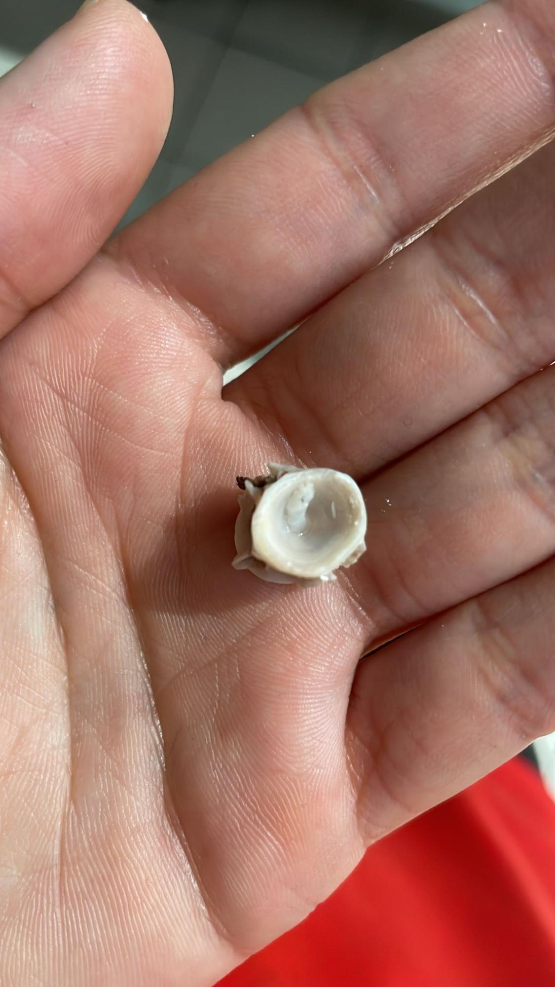 Metro Aro Ton Balığından Kemik Çıktı - Şikayetvar