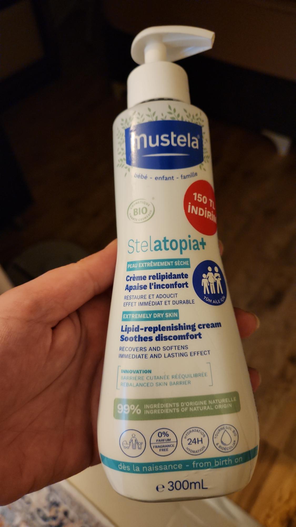 Baby Develops Rashes & Allergy Concerns After Using Mustela Products ...