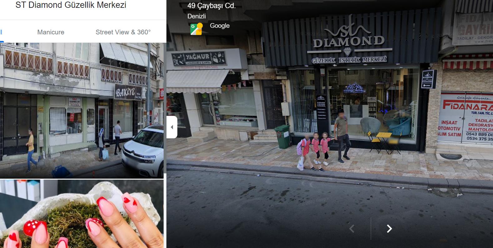 St Diamond Güzellik Merkezi Lazer Epilasyon Şikayeti - Şikayetvar