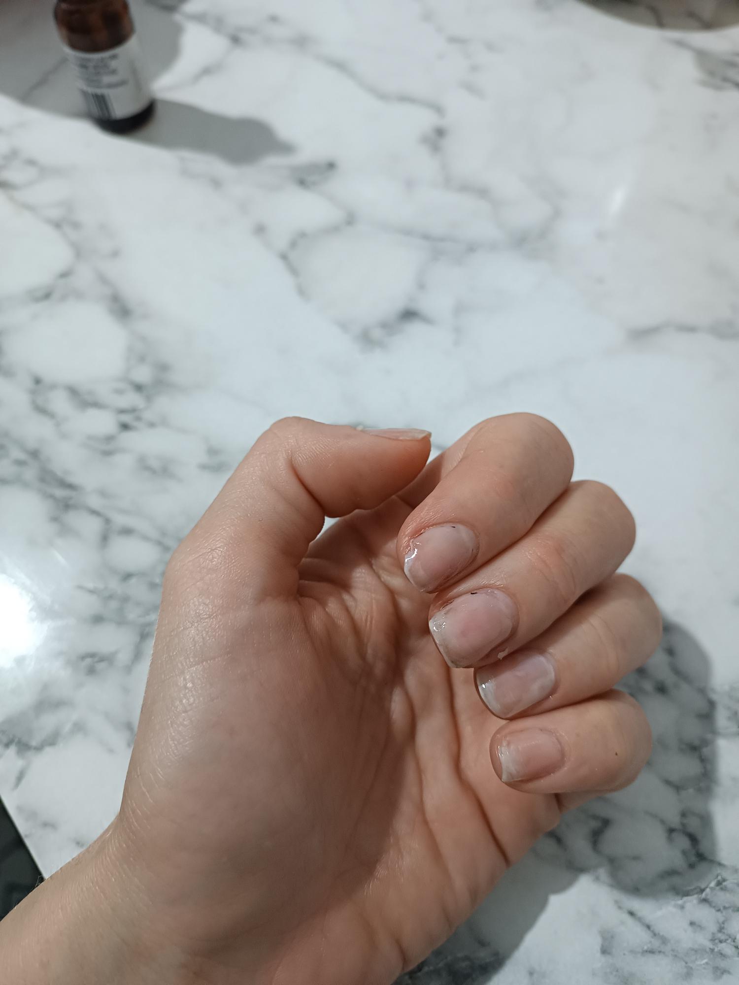 Antalya NailArt Protez Tırnak Antalya Nail Art Korkunç Tırnak Deneyimi ...