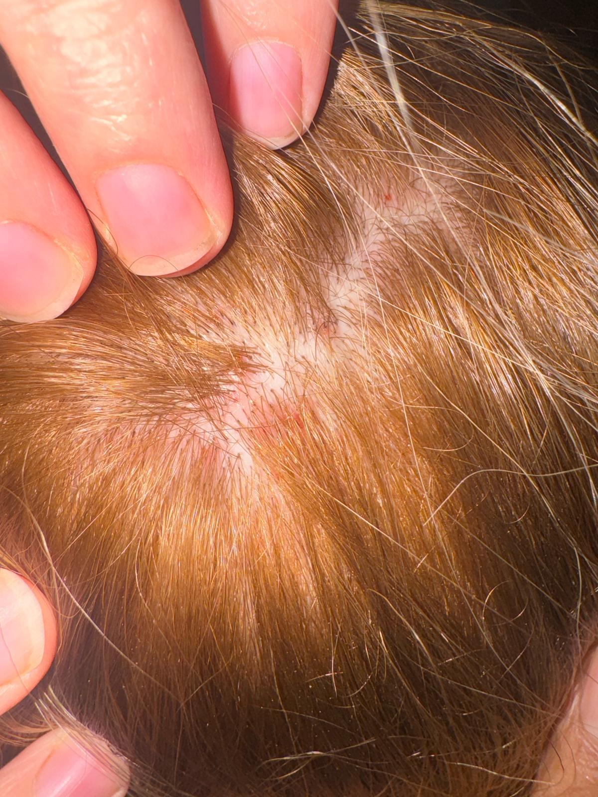 Palette Saç Boyasından Saç Derim Yandı - Şikayetvar