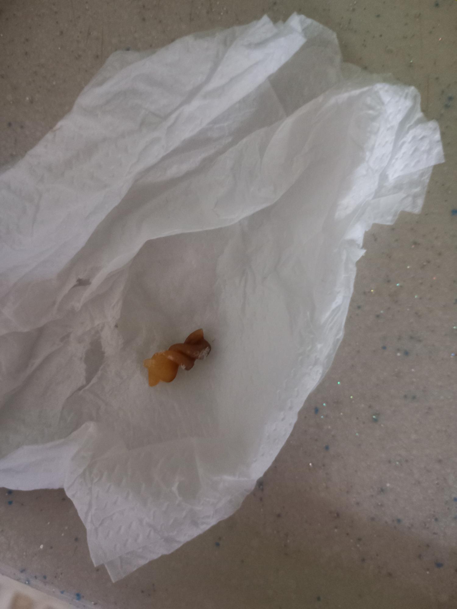 Nuh'un Ankara Makarnası Nuhun Ankara Makarnasının İçinden Küflü Siyah ...