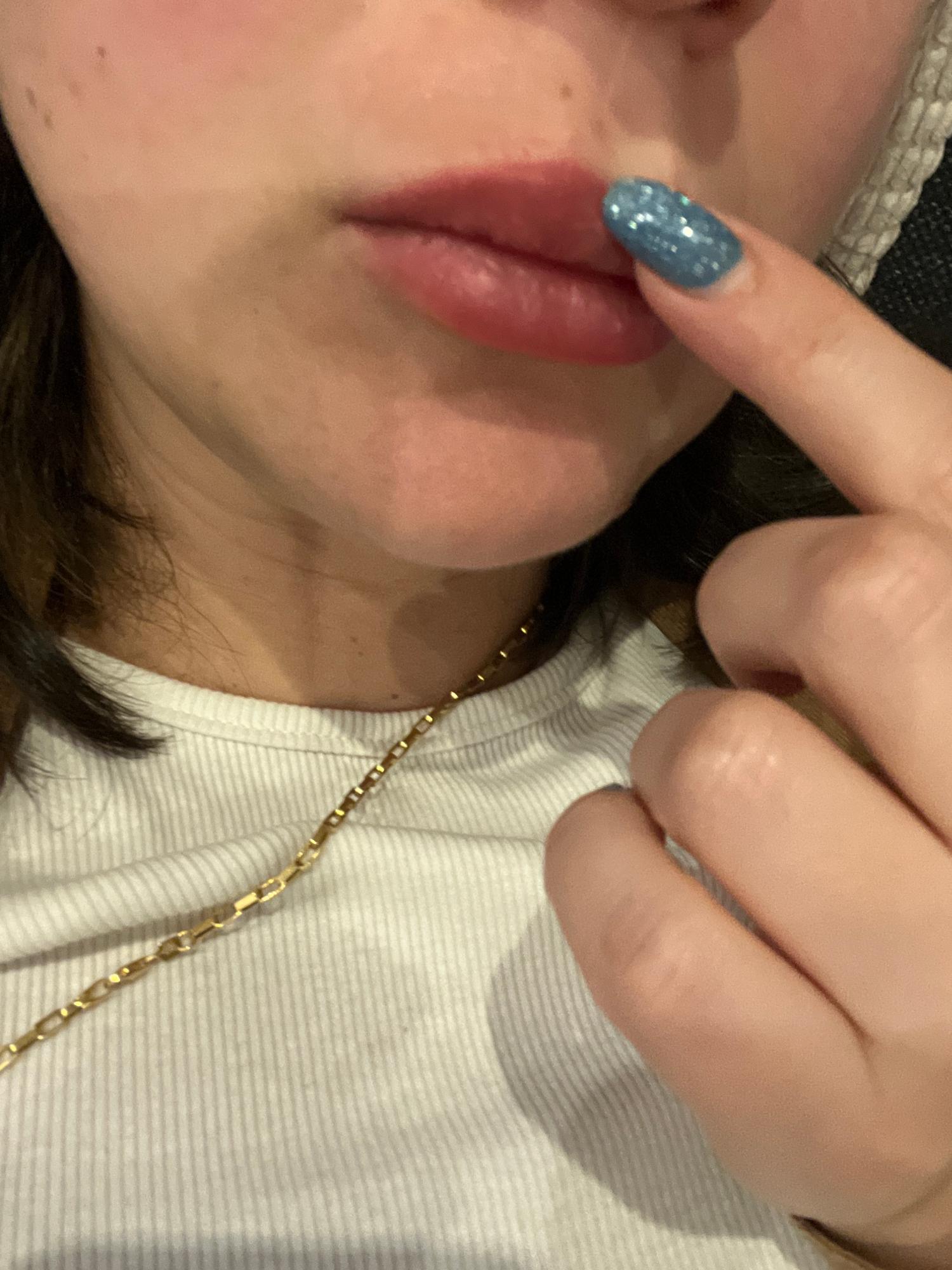 My Skin Broke Out After Using Bobbi Brown Vitamin Enriched Face Base Duo - Xolvie