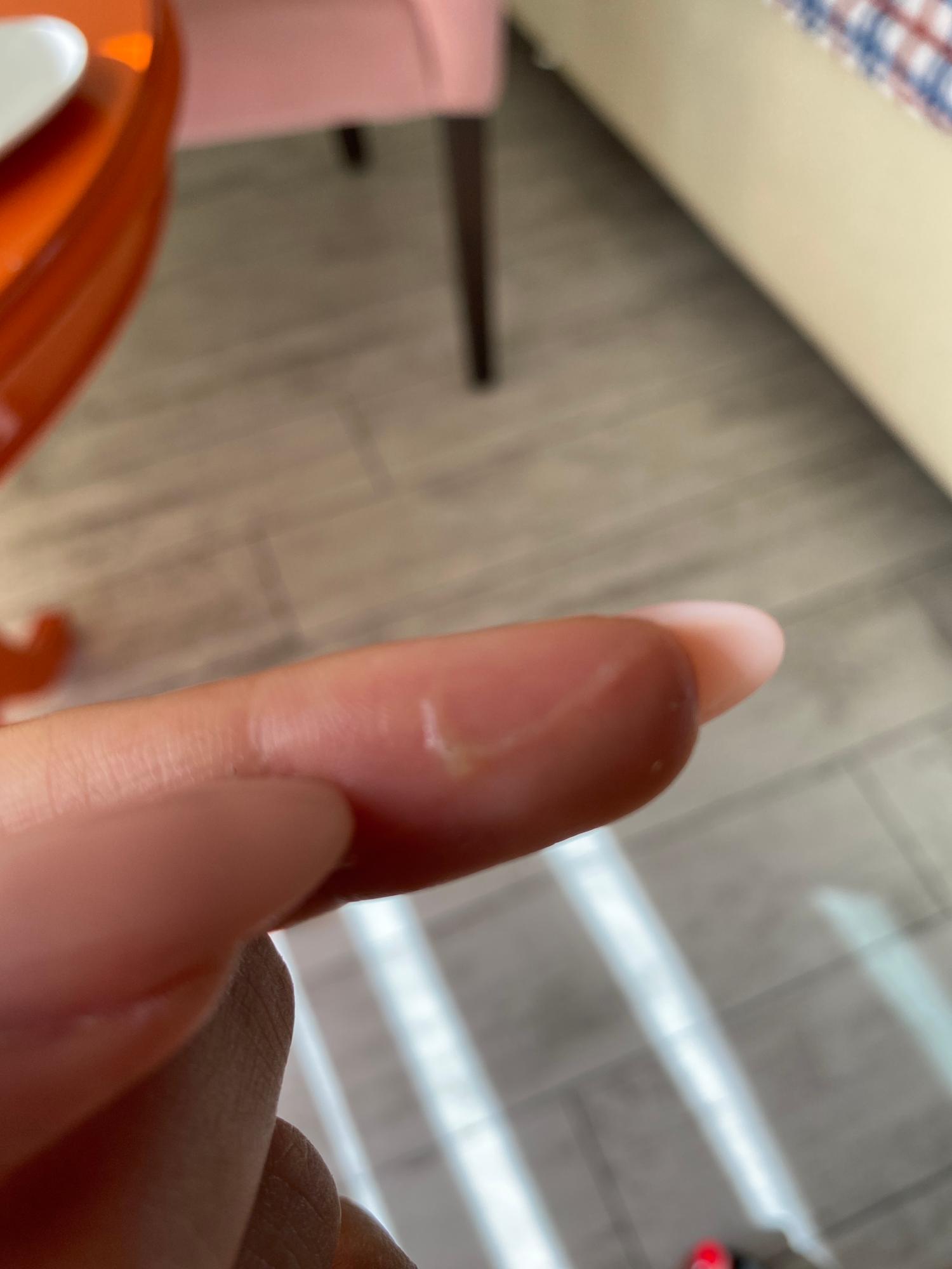 Sensodyne Ağızda Beyaz Salya - Şikayetvar