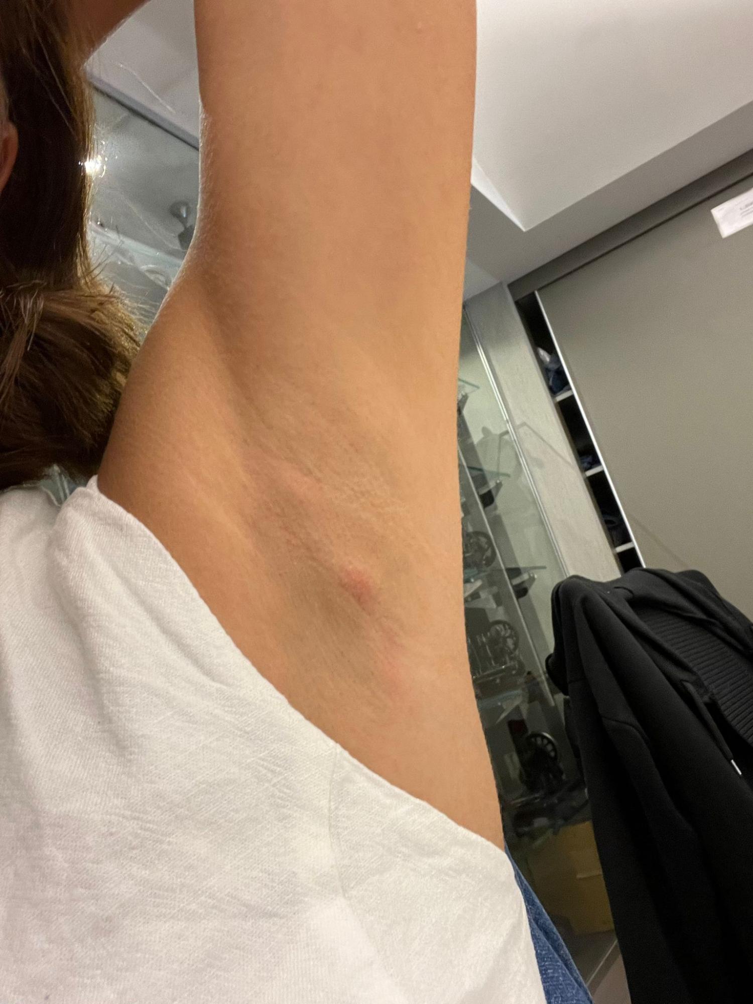 Rexona Clinical Protection Roll-on Koltuk Altı Bezesi - Şikayetvar