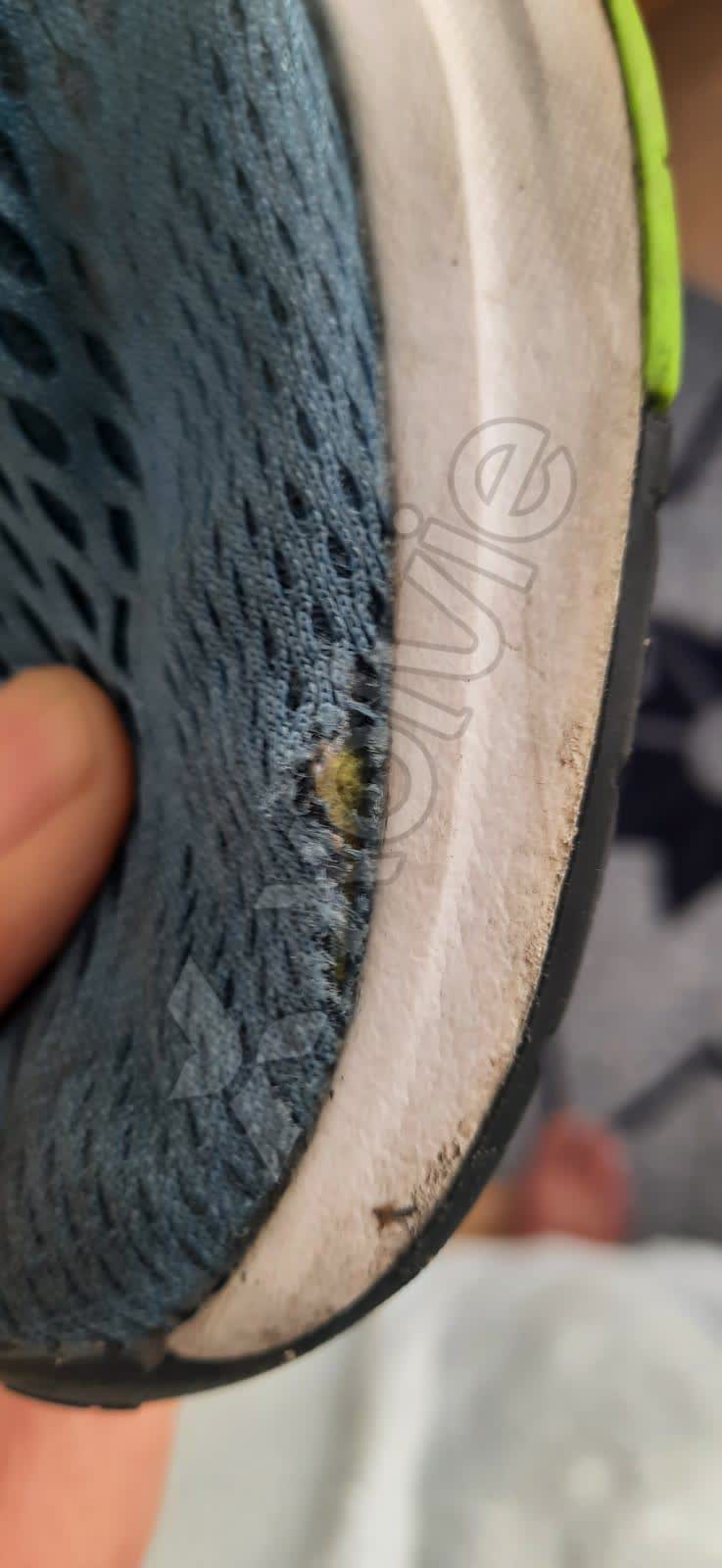Adidas Didn’t Honor the Warranty After My Running Shoes Fell Apart in ...