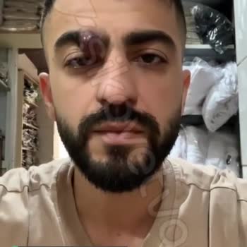 Doğa Sigorta Şirketi Şikayetleri - Şikayetvar