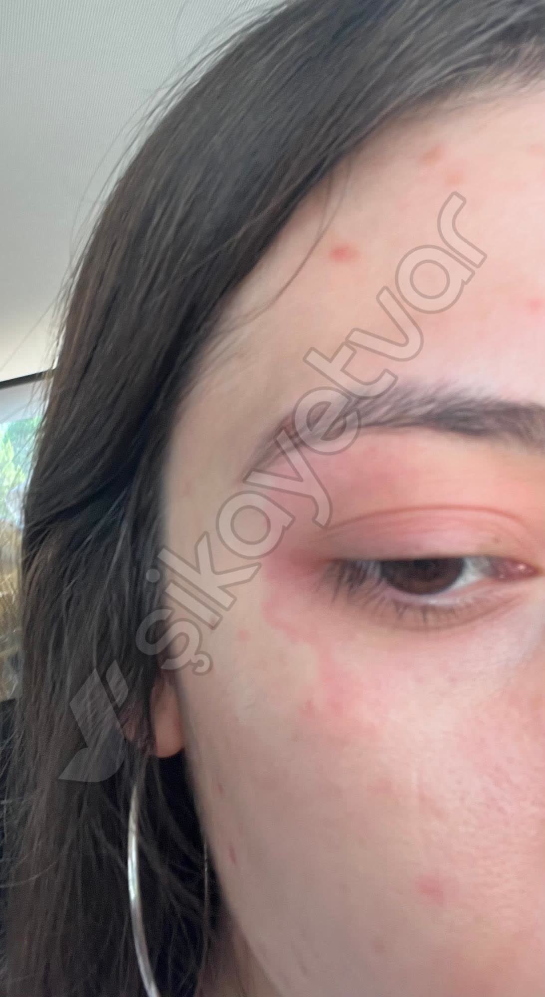 Lensoptik.com.tr Lens Optik Ve İconic Şikayetçiyim - Şikayetvar