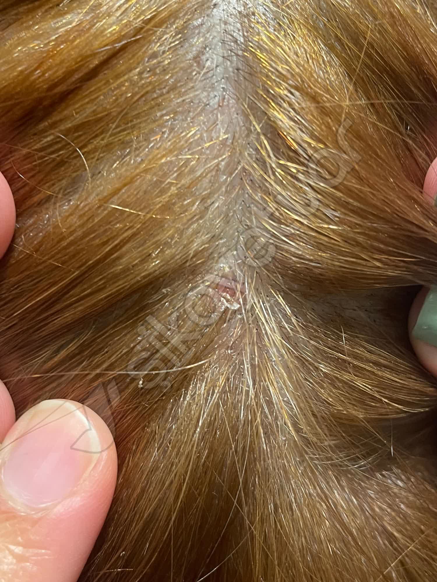 Palette Boyası: Saç Derisinde Yanma Ve Morarma Sorunu - Şikayetvar