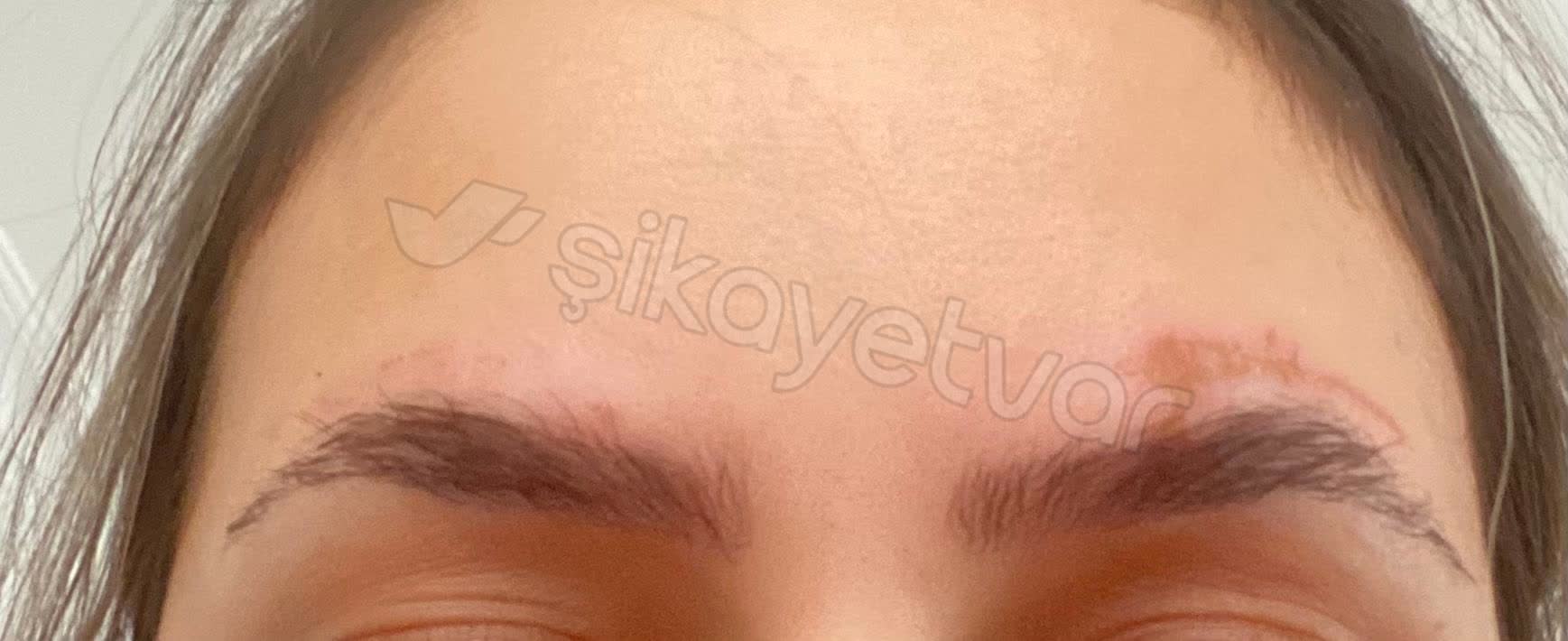 Sevim Alan Güzellik Merkezi Kaş Laminasyonu Ve Kirpik Lifting Kabusu ...