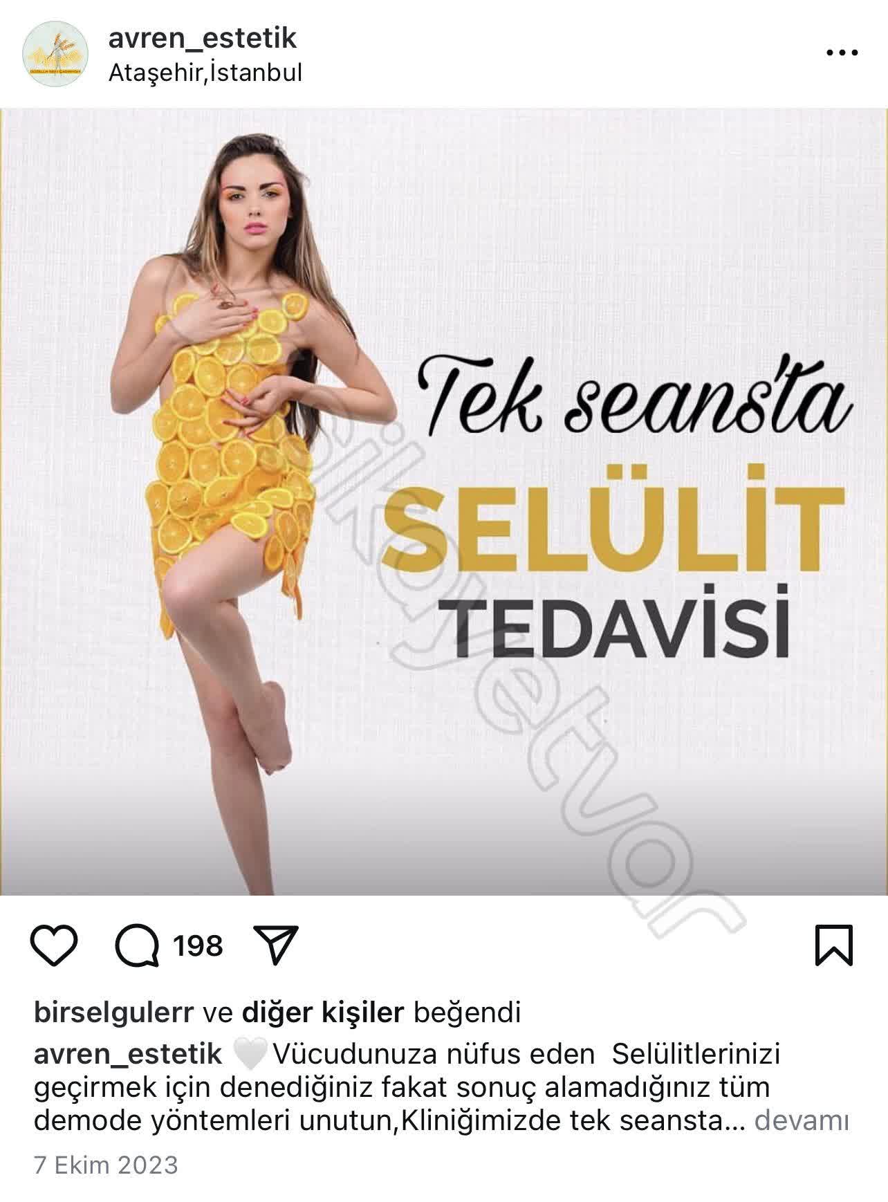 Avren Estetik Estetik Tedavi Sonrası Hayal Kırıklığı - Şikayetvar