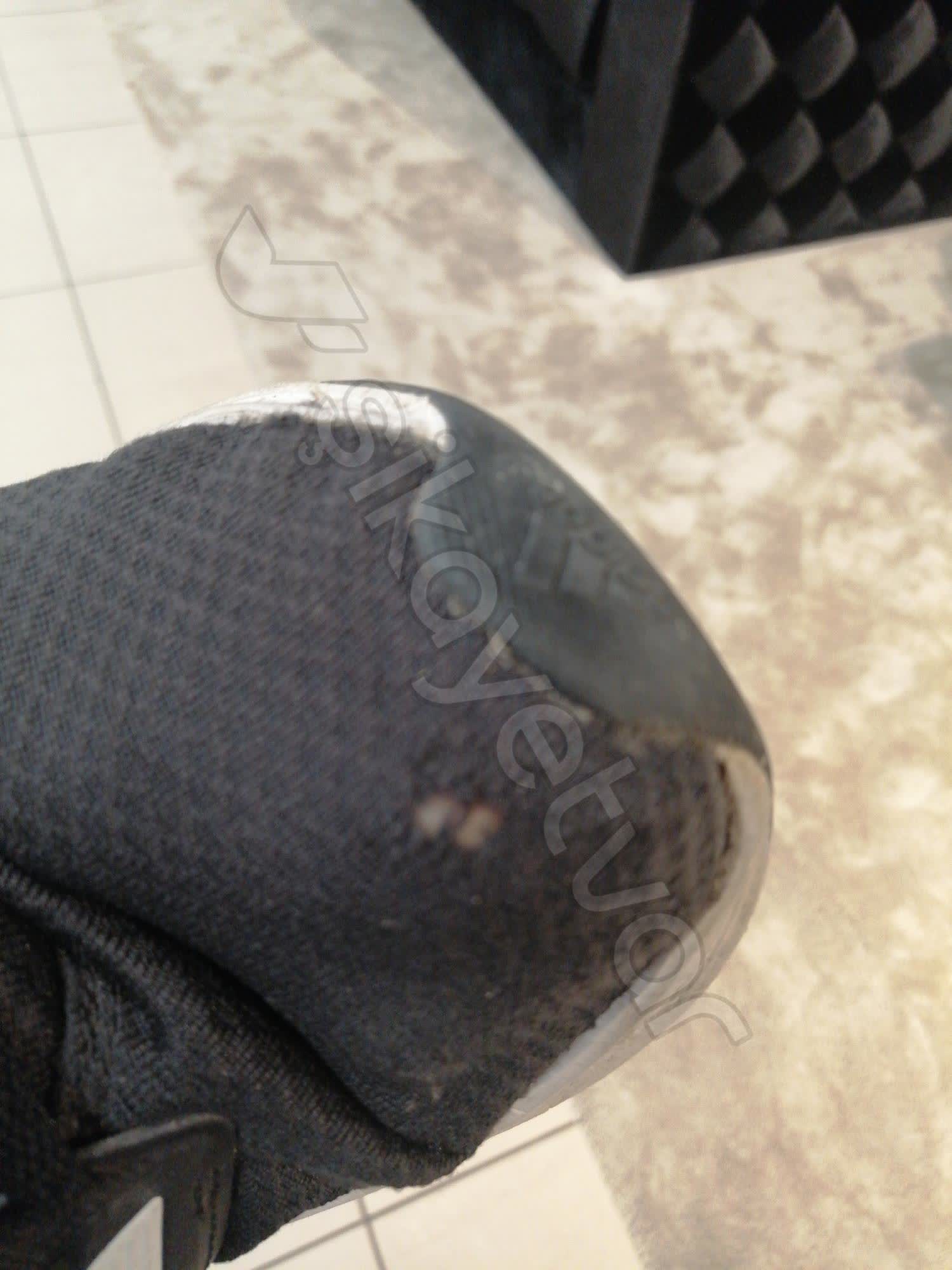 Adidas Ayakkabıda 3 Ayda Delinme Ve Astar Yırtılması Şoku - Şikayetvar