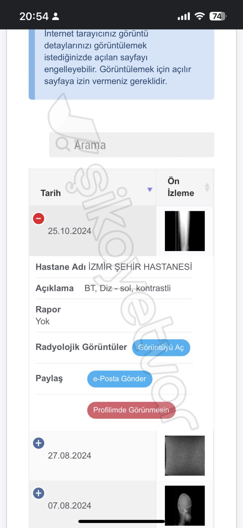 İzmir Bayraklı Şehir Hastanesi Hastane Raporu Gecikmesi Ve Ameliyat ...