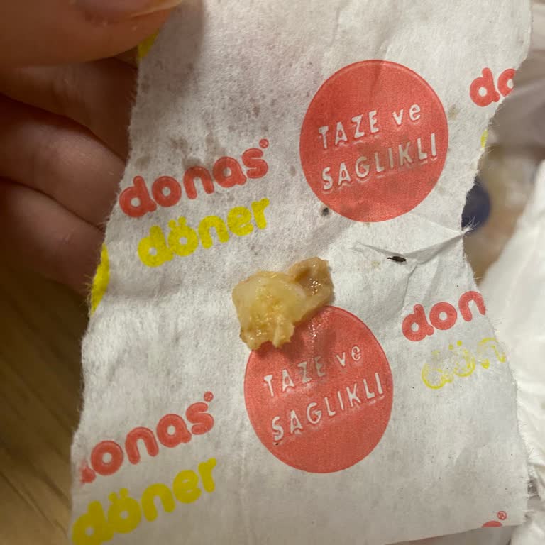 Donas Döner Siparişimde Kıkırdak Şoku! - Şikayetvar