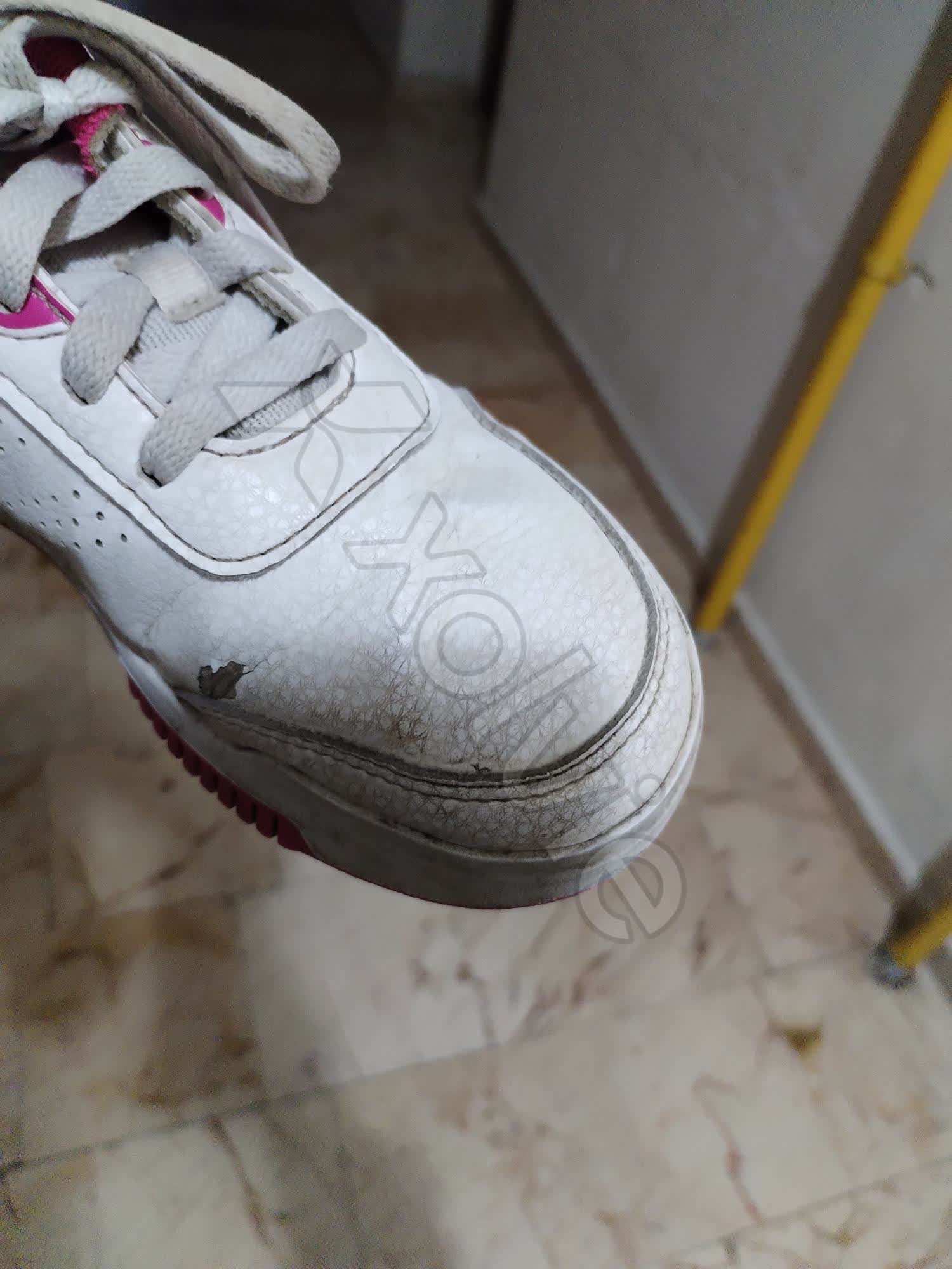 Adidas Shoes Deformed in Two Months and Warranty Blamed Misuse - Xolvie