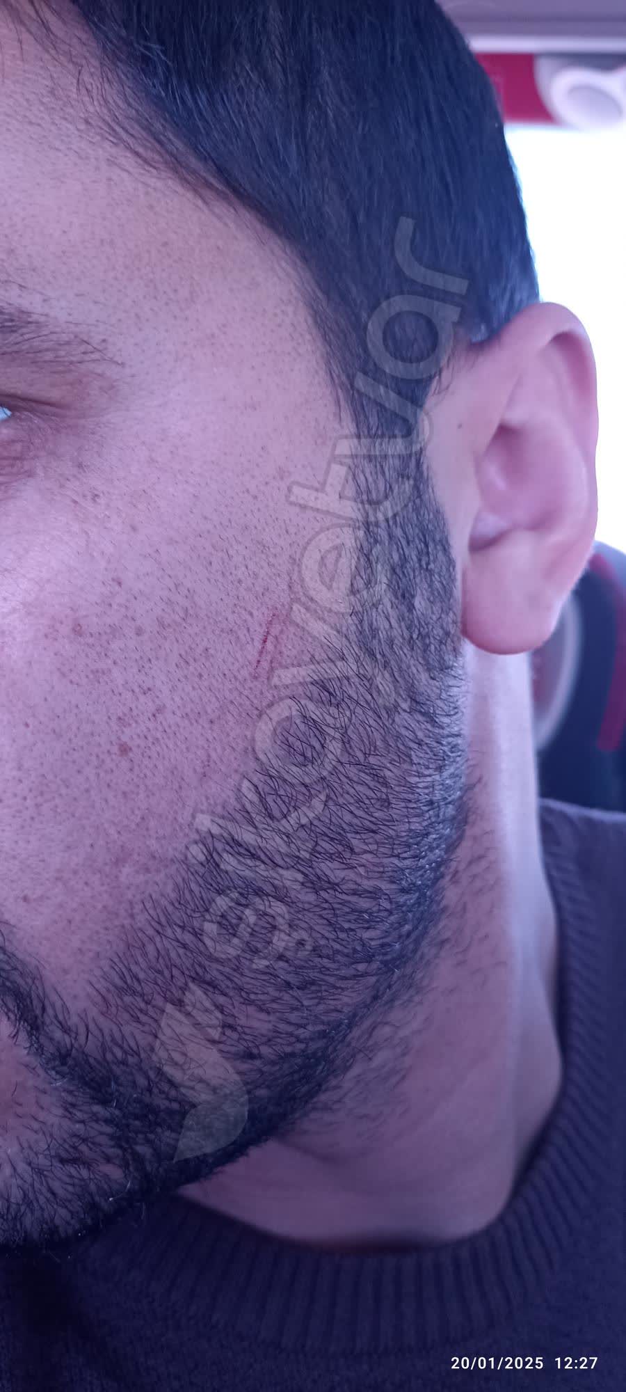 Van Kalesi Turizm Otobüste Şiddet Ve İhmalkarlık - Şikayetvar