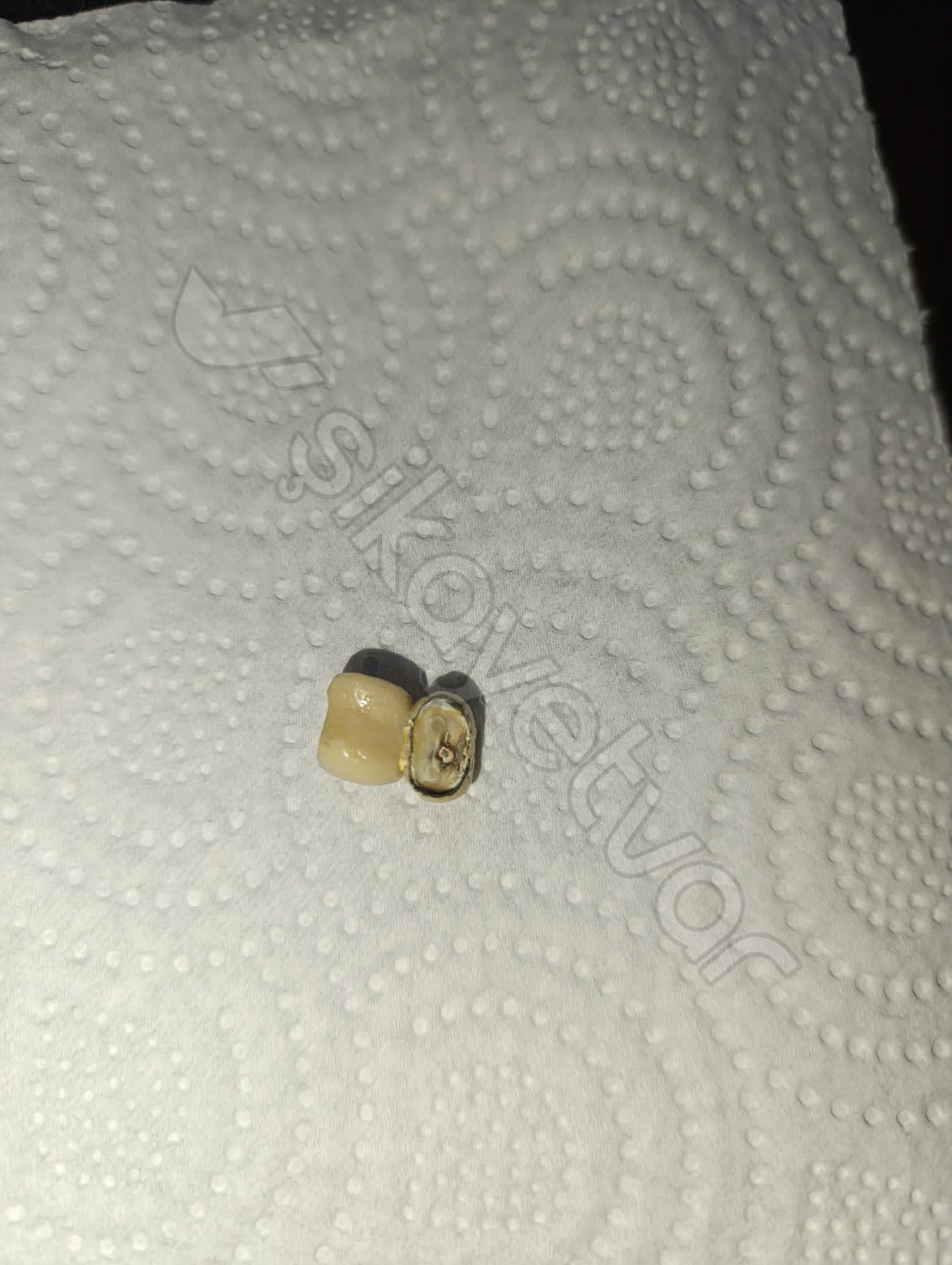 Beyaz Işık Diş Poliklinikleri Beyaz Işık Diş Poliklinikleri Diş ...