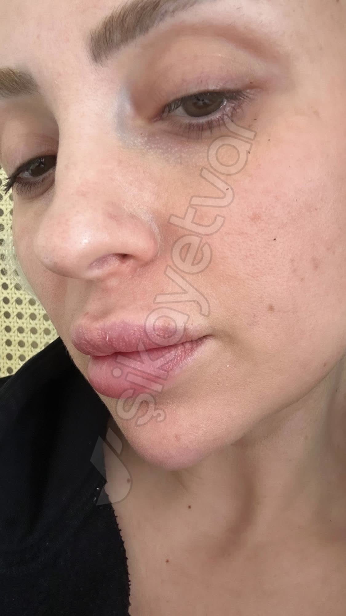 Lavinya Golden Ankara Lavinya Güzellik Merkezi'nde Hayal Kırıklığı ...