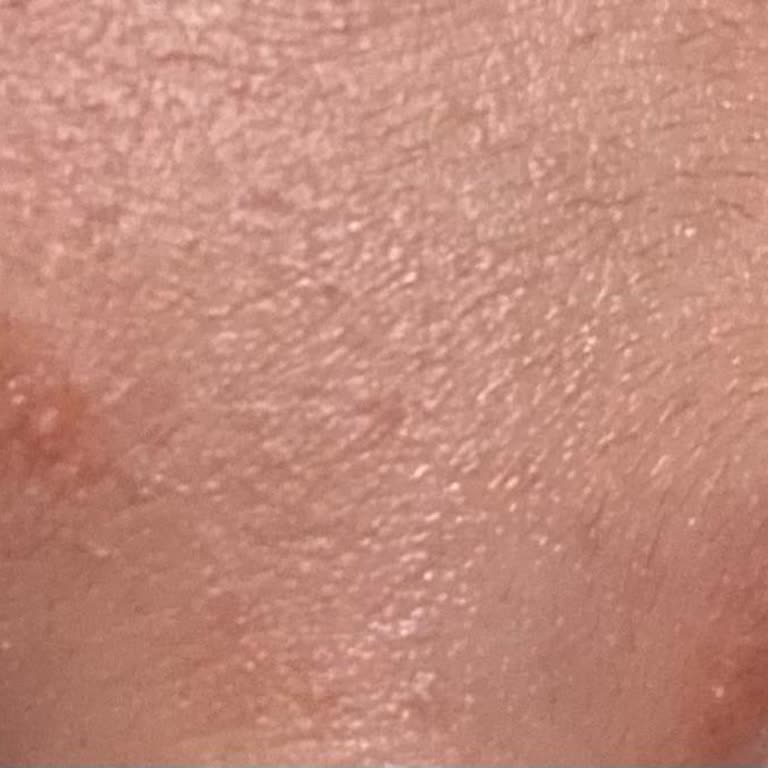 Mustela Baby Shampoo Caused Dry Skin and Rash on My Newborn - Xolvie