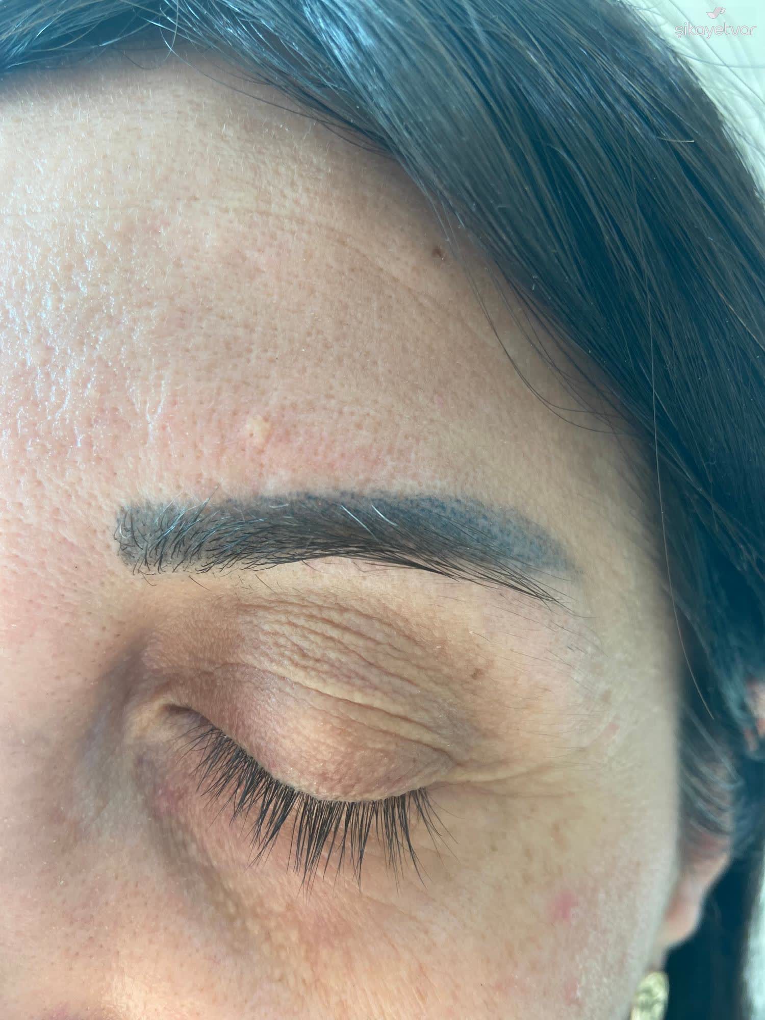 Derin Dindin Güzellik Merkezi Microblading Mağduriyeti Ve Saygısız ...