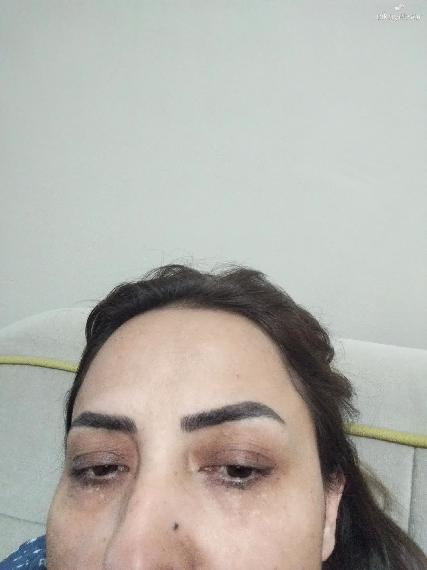 Sibel Kalkan Official Yanlış Kaş Rengi Mağduriyeti - Şikayetvar