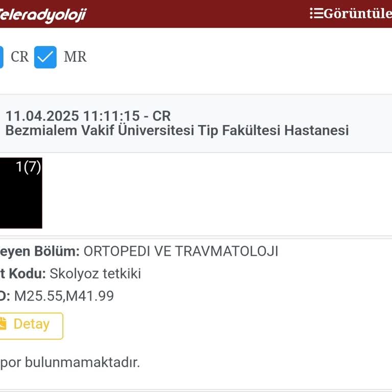 Bezmiâlem Hastanesi Hastane Raporu İçin Beklemekten Usandım - Şikayetvar