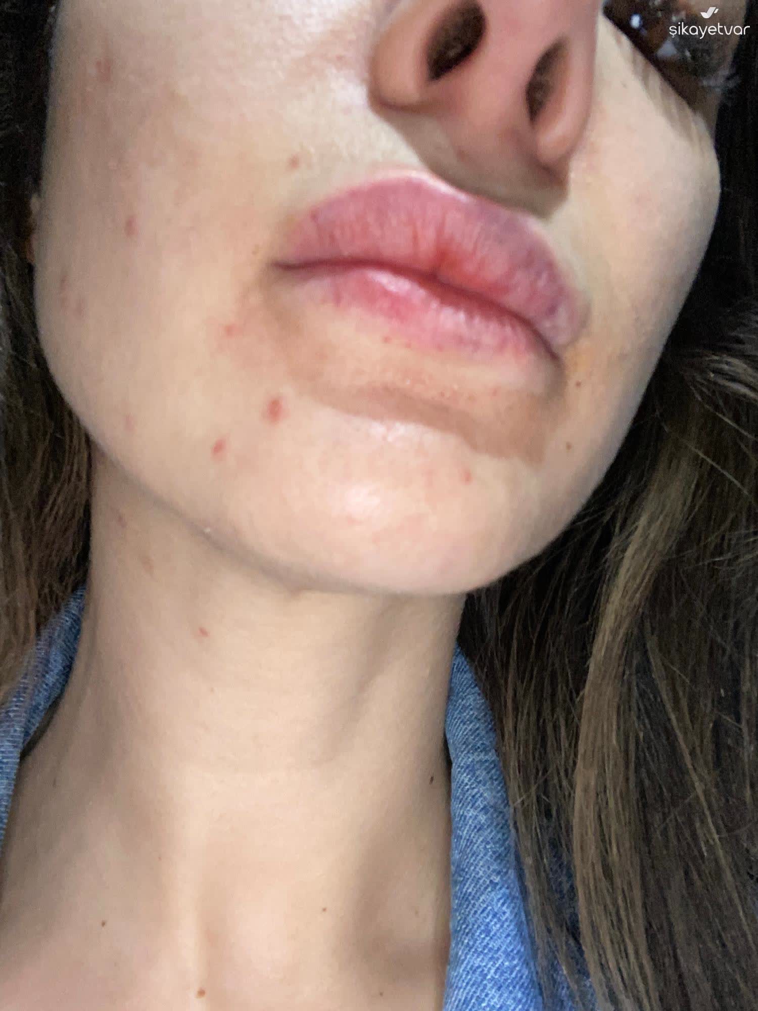 Dr. Alpay Yıldız Memnun Kalmama - Şikayetvar