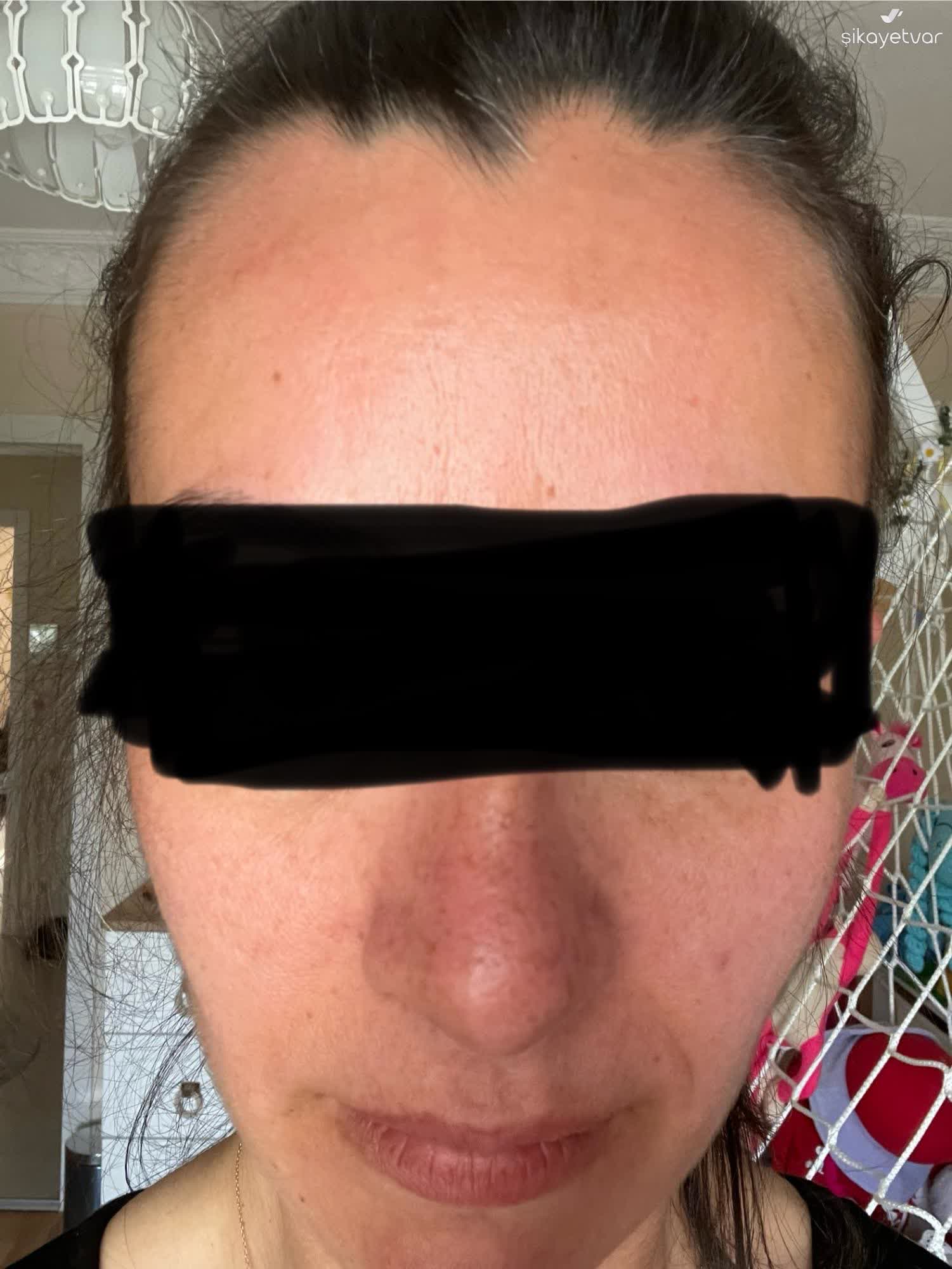Estee Lauder SPF 50 Sunscreen Caused Redness and Failed to Protect My ...