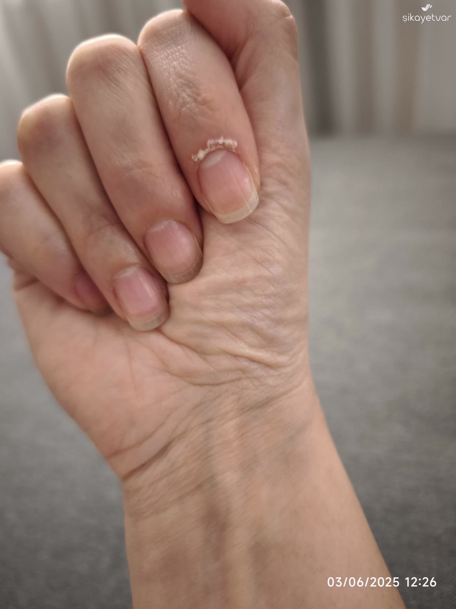 Vanish Kosla Kosla Vanish Oxi Action Teması Sonrası Deride Beyazlaşma ...