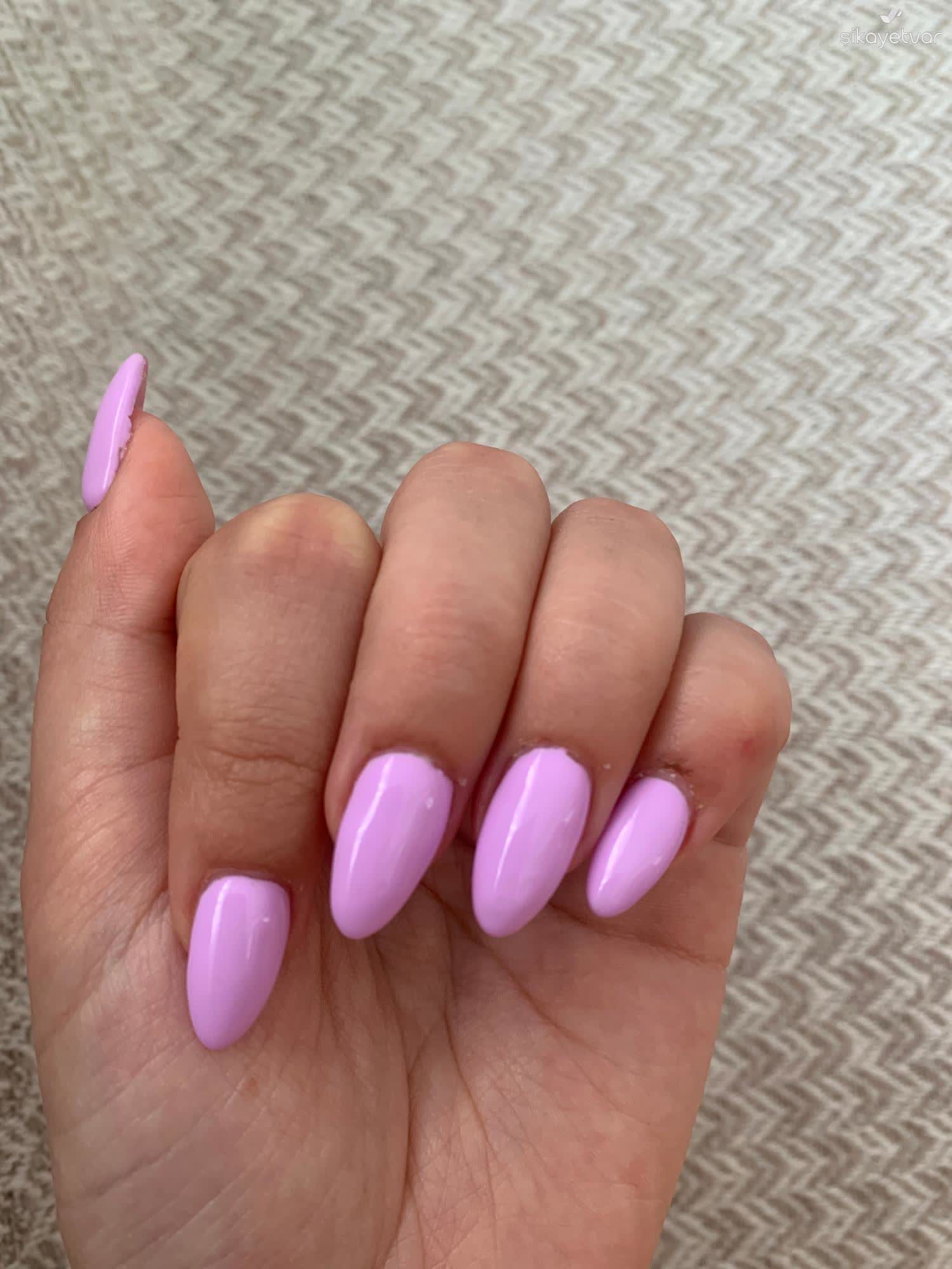 Nail Time | Ataköy Protez Tırnak Sonrası Ağrı, İltihap Ve Kötü Uygulama ...