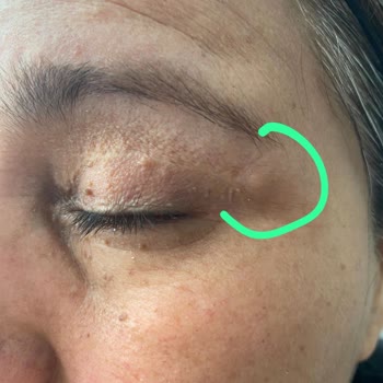 Aktif International Hospital Aktif International Hospital Bana Gösterdikleri Resimle ...