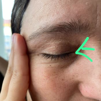 Aktif International Hospital Aktif International Hospital Bana Gösterdikleri Resimle ...