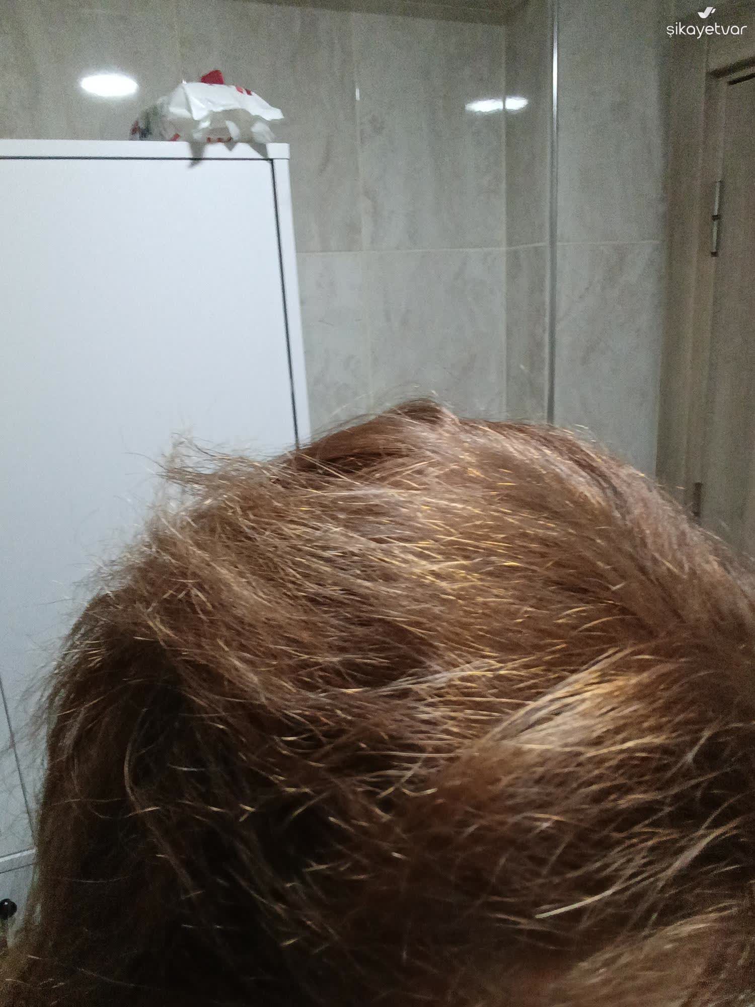 Schwarzkopf Saç Derimde Yanık Ve Aşırı Dökülme Yaşadım - Şikayetvar